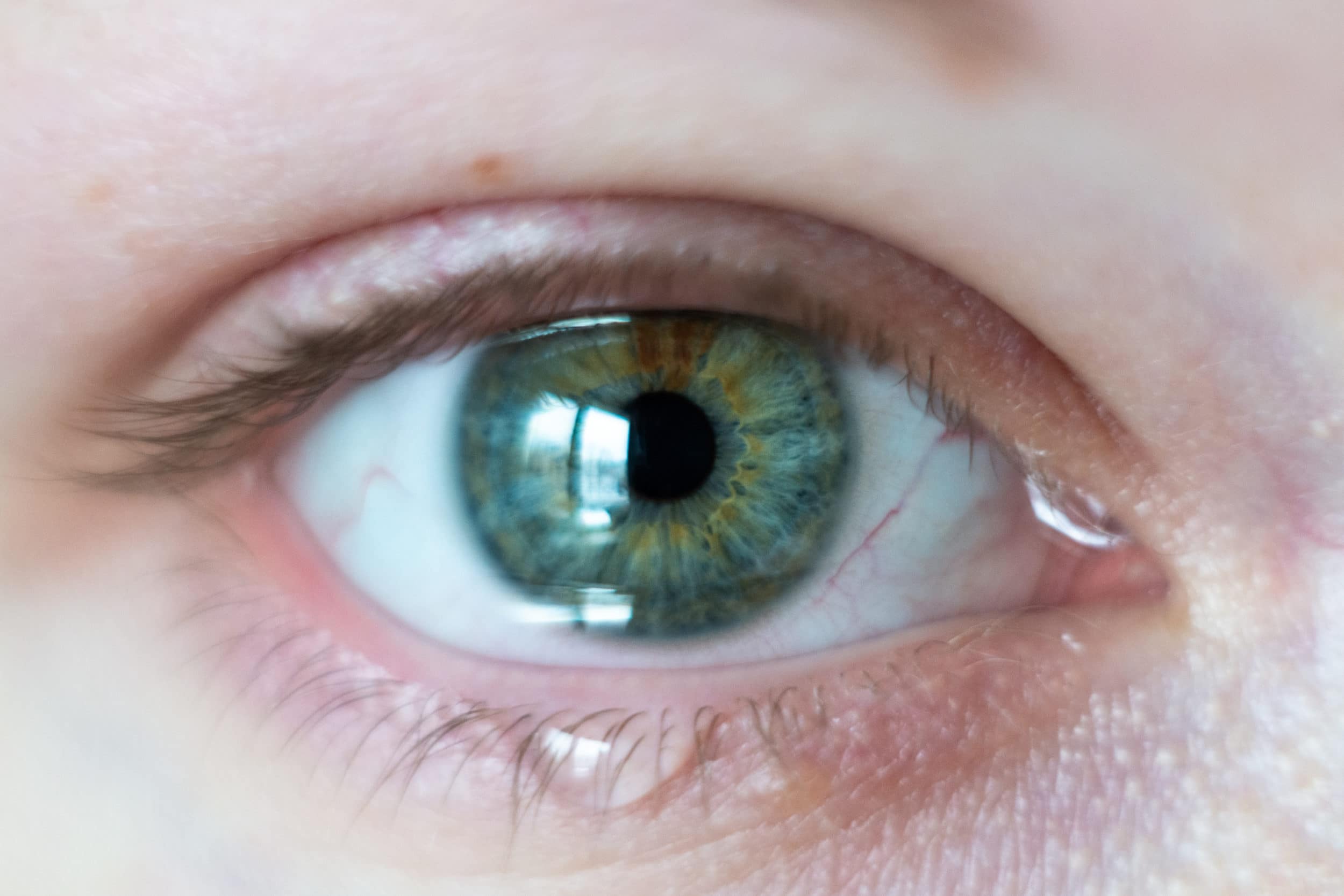 Dry Eyes May Be Worse During Stay at Home Order Loveland